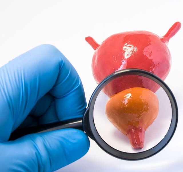 Cáncer de próstata nuevos métodos para tratarlo - Nota Médica